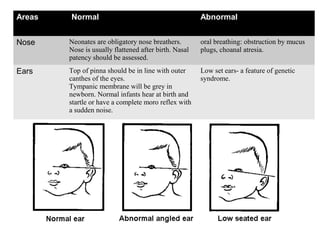 Newborn assessment | PPT