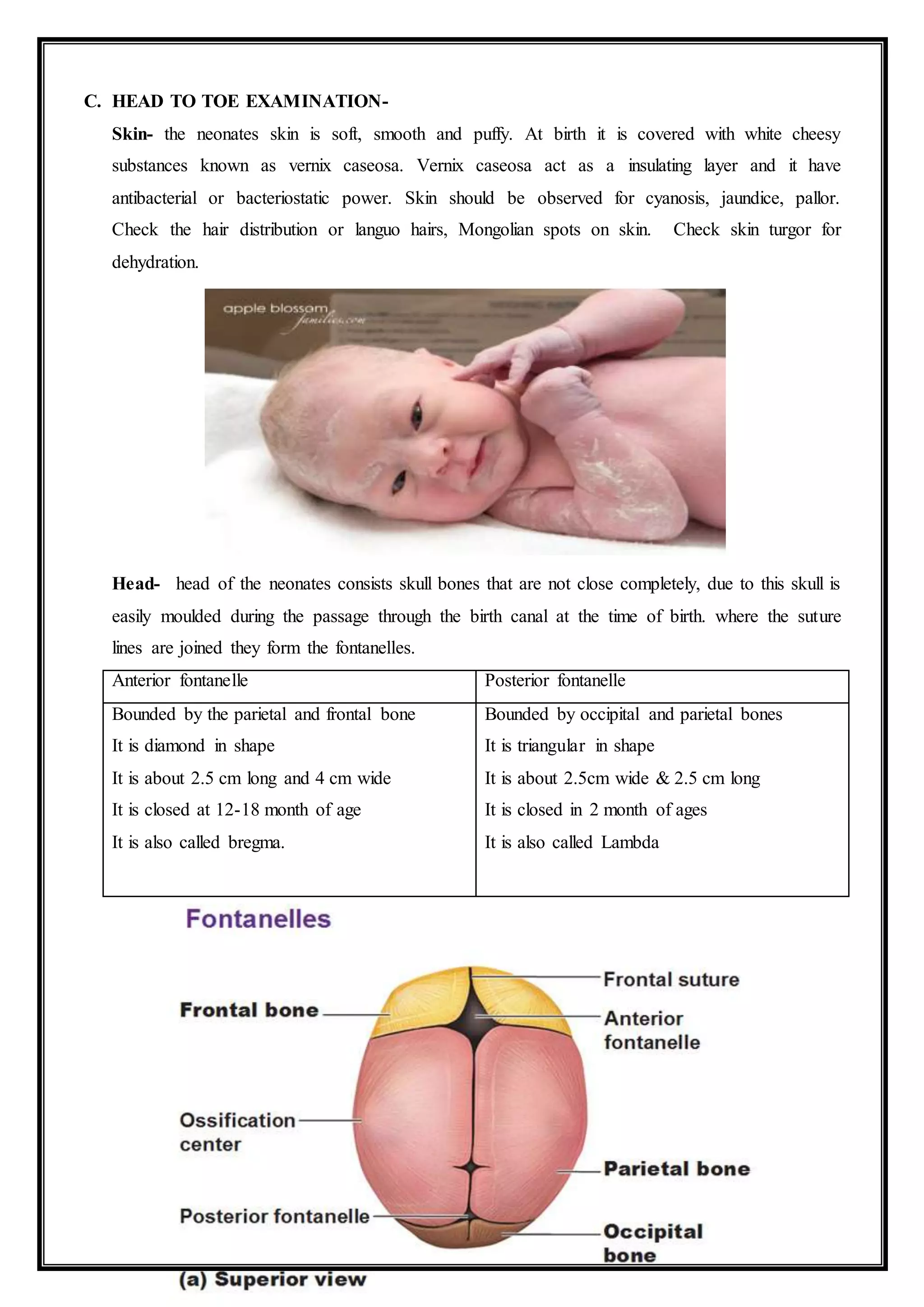 Newborn assessment | DOCX