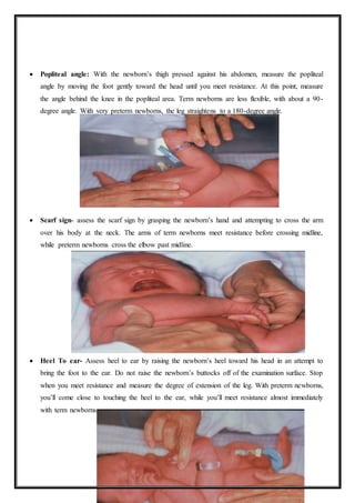 Newborn assessment | DOCX