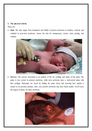Newborn assessment | DOCX
