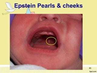 Newborn assessment | PPT