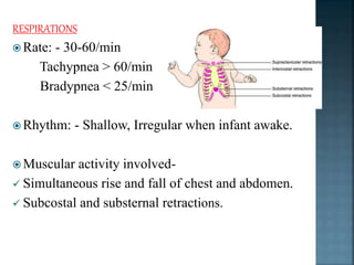 newborn assessment.pptx