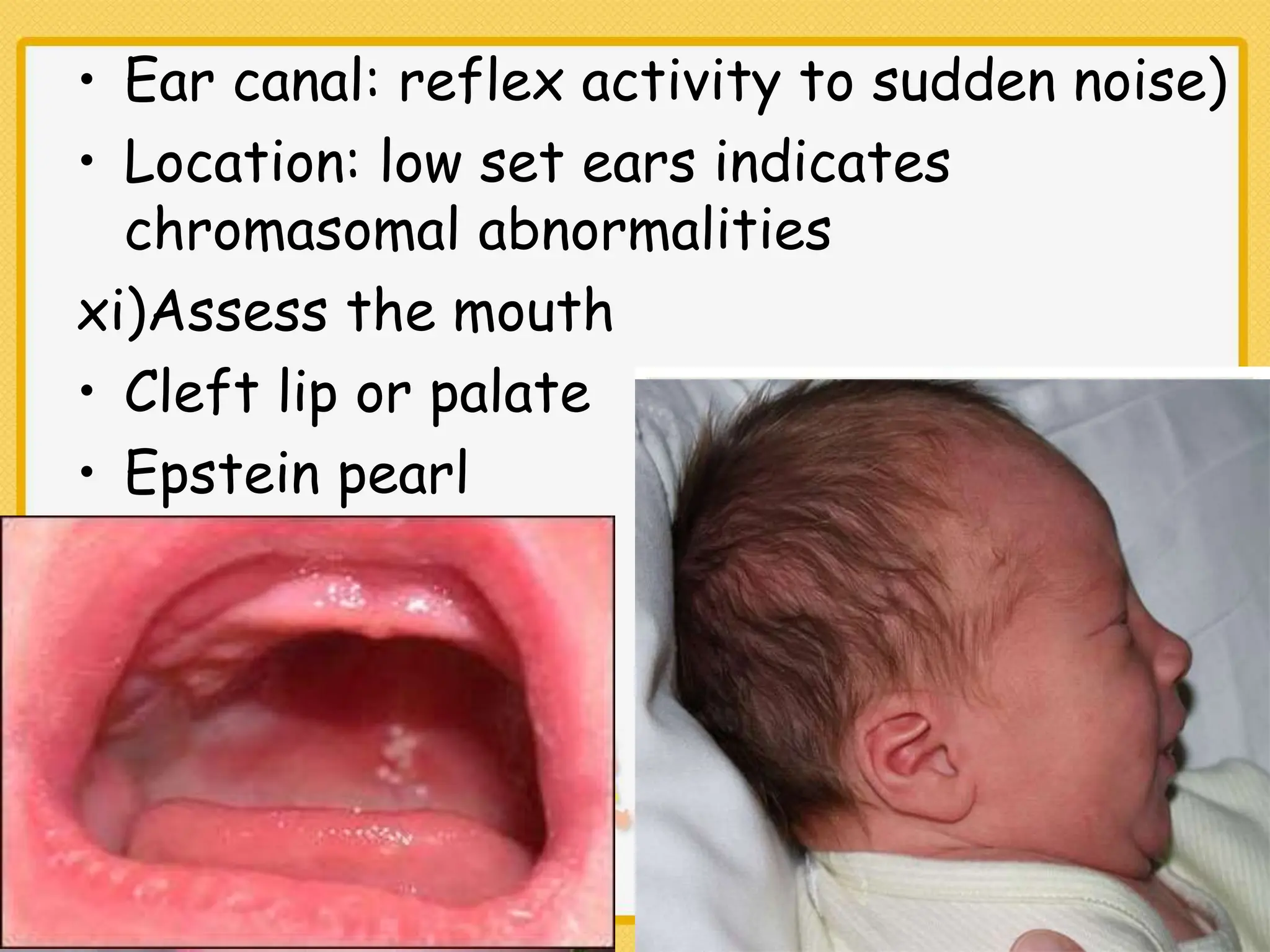 neonatal assessment ppt - shani jyothis | PPT