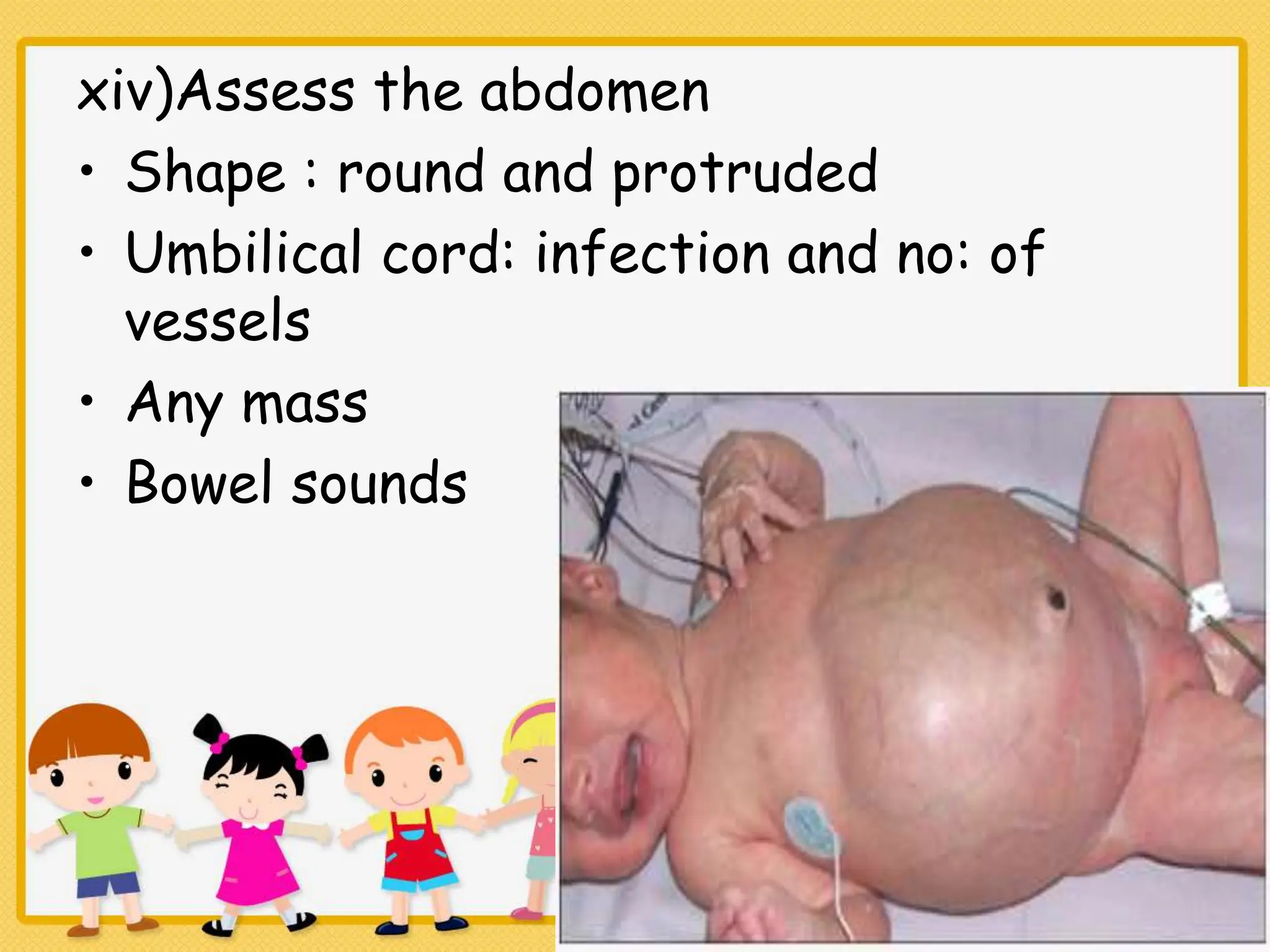 neonatal assessment ppt - shani jyothis | PPT