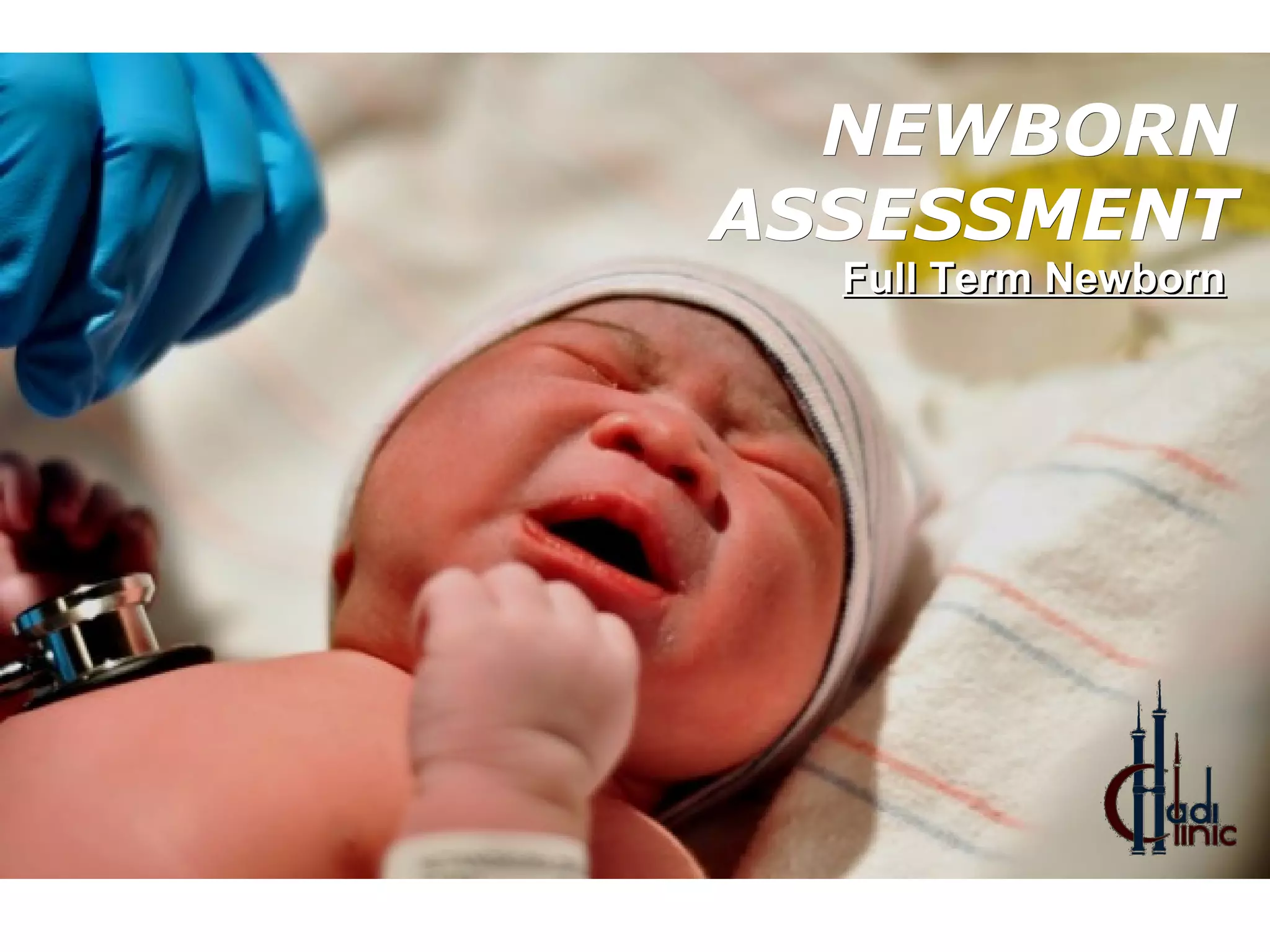 Newborn Assessment by Hadi Hospital NICU. | PPS