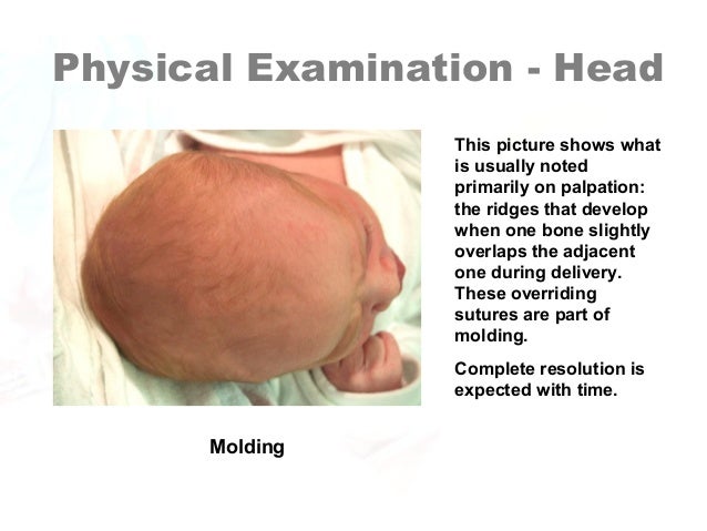 Newborn Assessment by Hadi Hospital NICU.