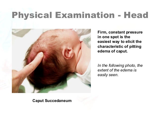Newborn Assessment by Hadi Hospital NICU.