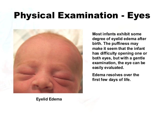 Newborn Assessment by Hadi Hospital NICU.