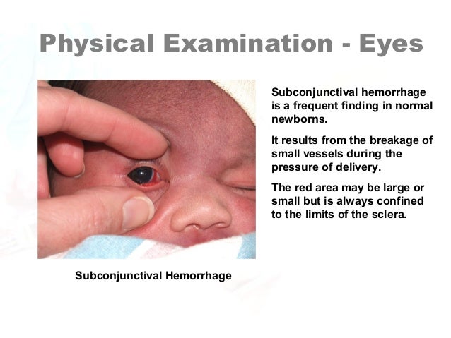 Newborn Assessment by Hadi Hospital NICU.