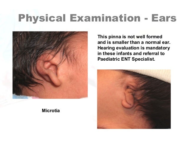 Newborn Assessment by Hadi Hospital NICU.
