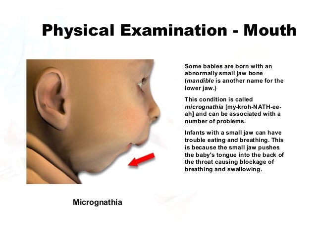 Newborn Assessment by Hadi Hospital NICU.