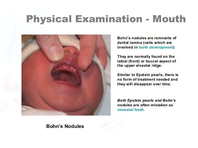 Newborn Assessment by Hadi Hospital NICU.