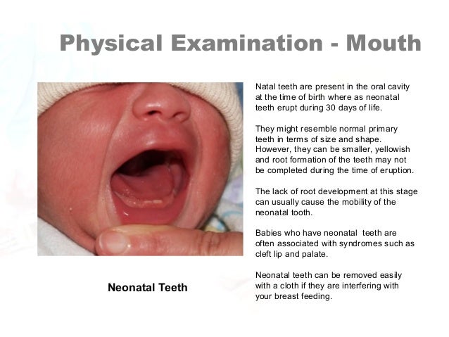 Newborn Assessment by Hadi Hospital NICU.