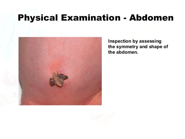 Newborn Assessment by Hadi Hospital NICU.