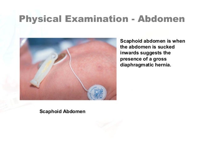 Newborn Assessment by Hadi Hospital NICU.