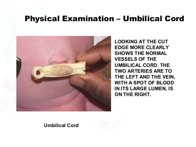 Newborn Assessment by Hadi Hospital NICU.
