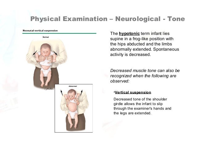 Newborn Assessment by Hadi Hospital NICU.