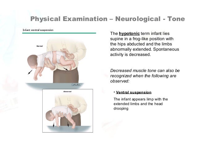 Newborn Assessment by Hadi Hospital NICU.