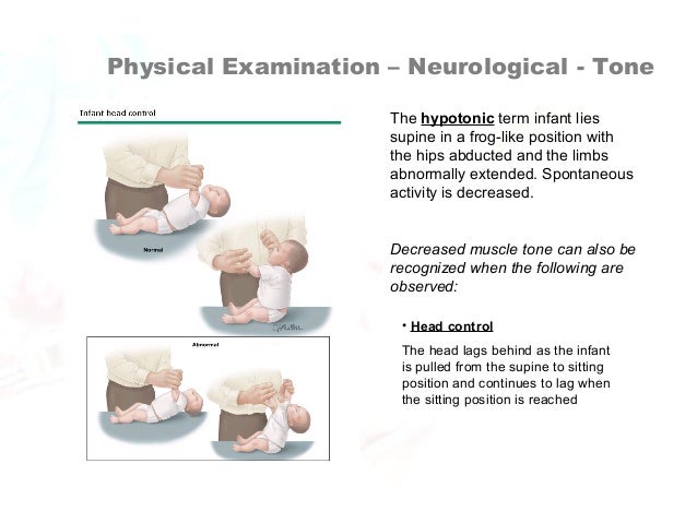 Newborn Assessment by Hadi Hospital NICU.