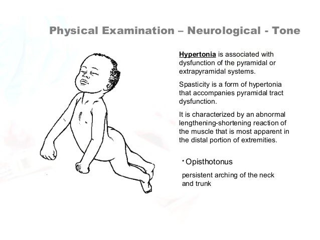 Newborn Assessment by Hadi Hospital NICU.
