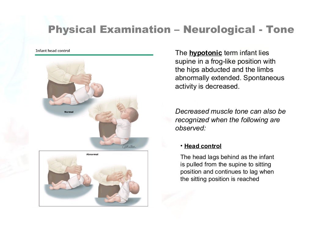 Newborn Assessment By Hadi Hospital Nicu Hadi Clinic