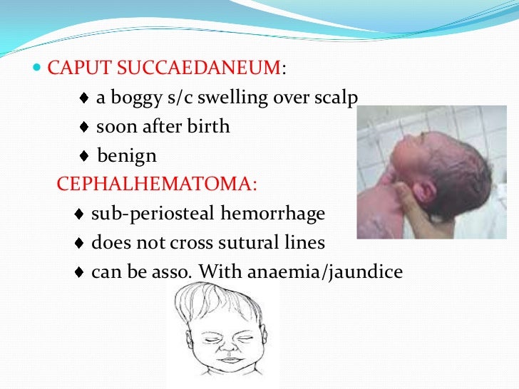 Newborn care..skp