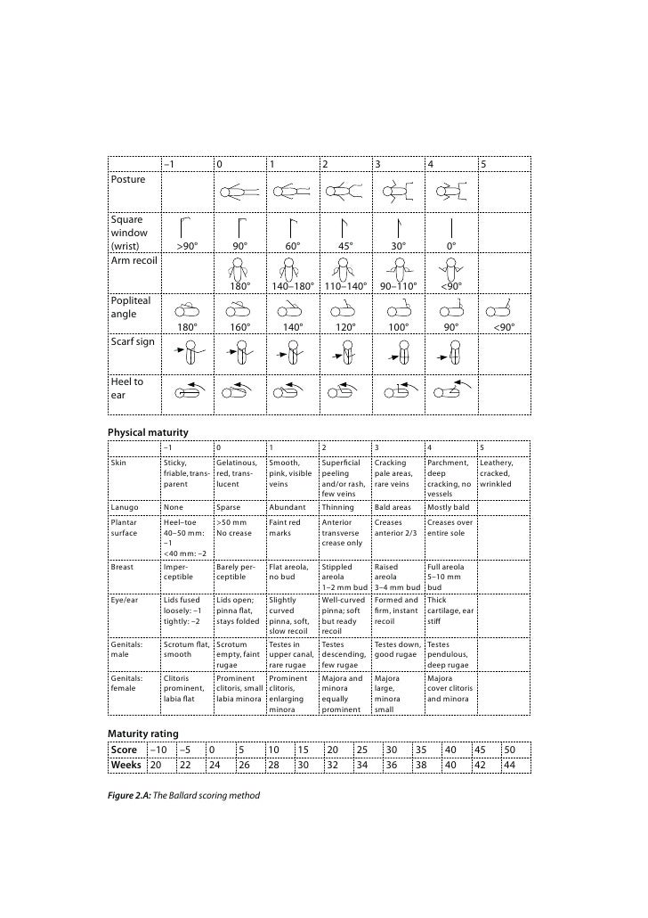 Newborn Care: Skills workshop Gestational age and weight.
