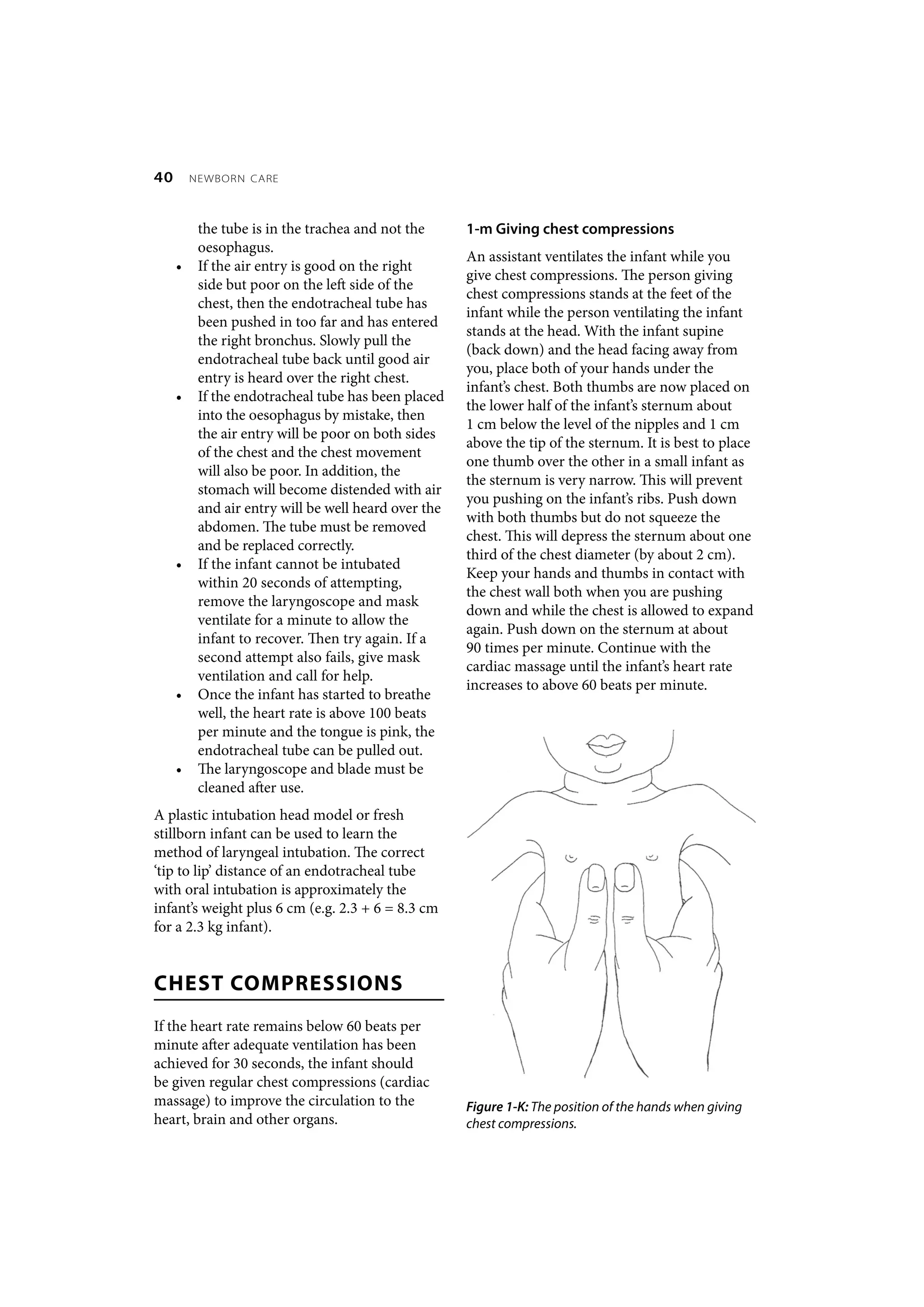 Newborn Care: Skills workshop Neonatal resuscitation | PDF