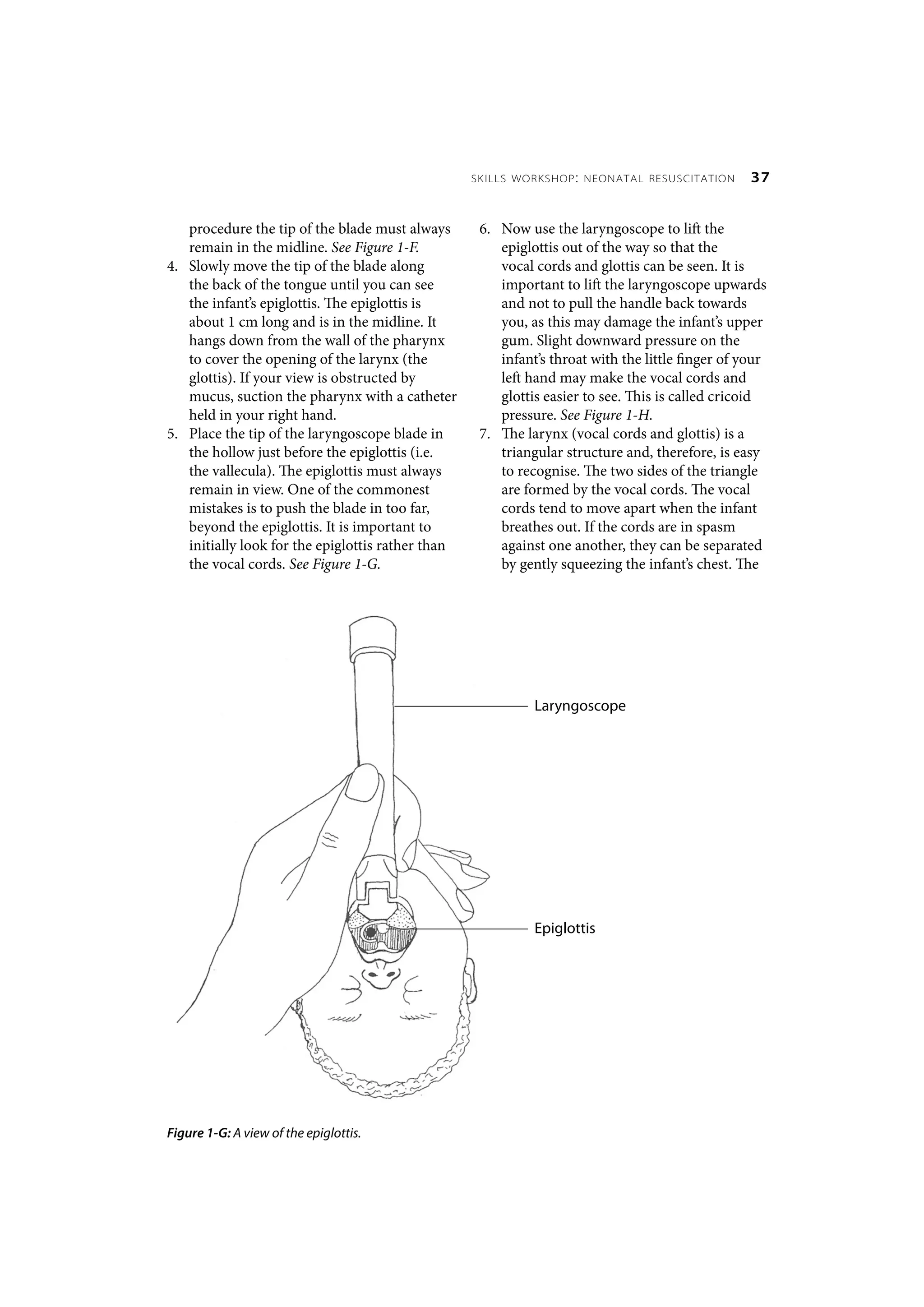 Newborn Care: Skills workshop Neonatal resuscitation | PDF