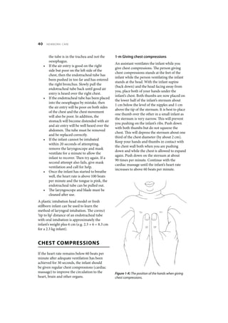 Newborn Care: Skills workshop Neonatal resuscitation | PDF