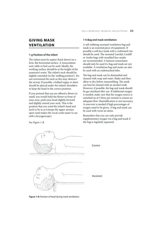 Newborn Care: Skills workshop Neonatal resuscitation | PDF