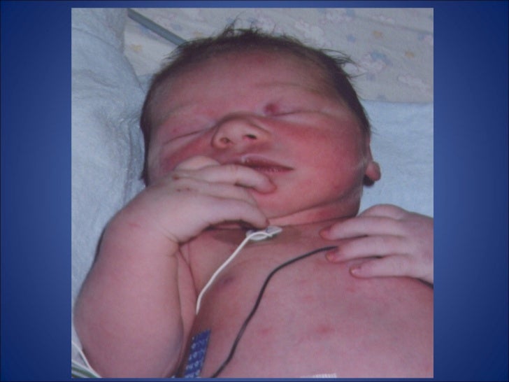newborn-examination