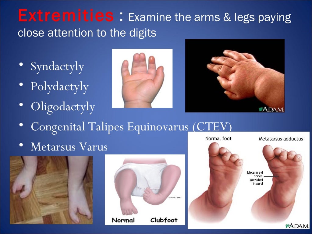 newborn-examination