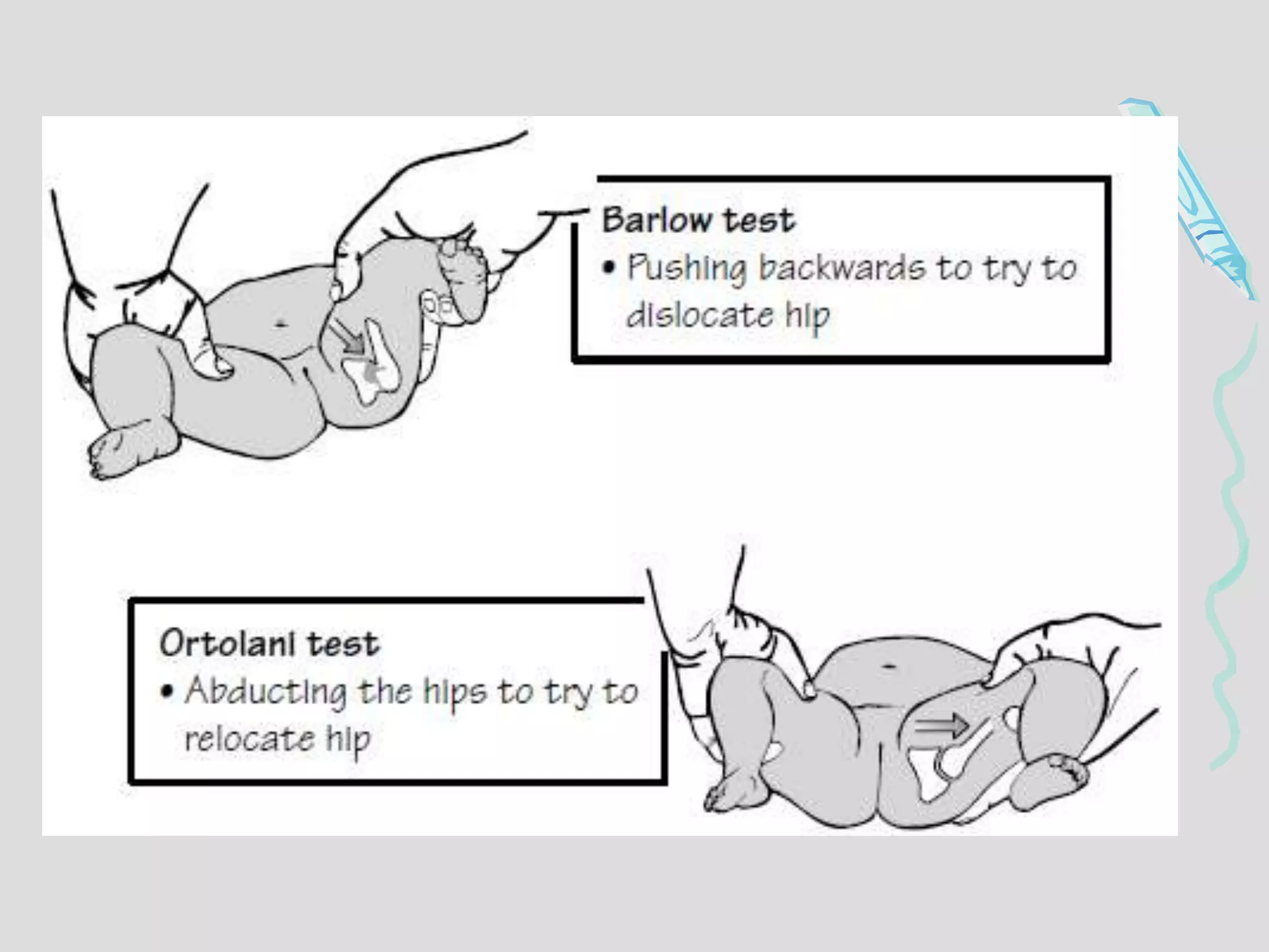 New born examination | PPTX