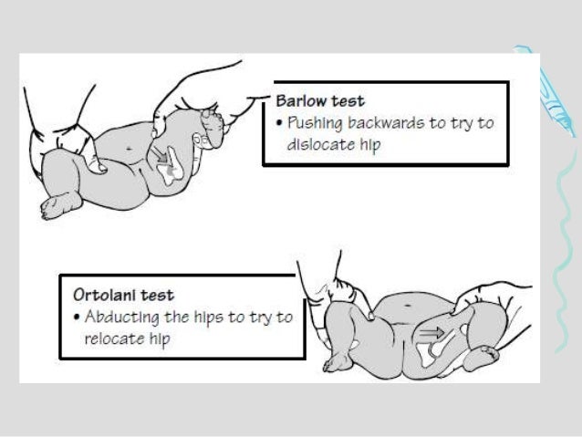 New born examination