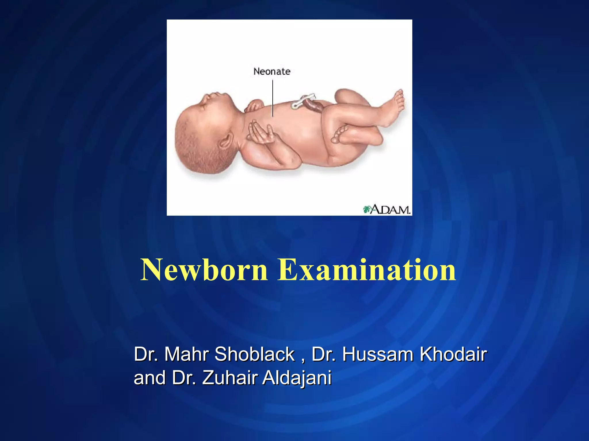 Newborn Examination | PPT