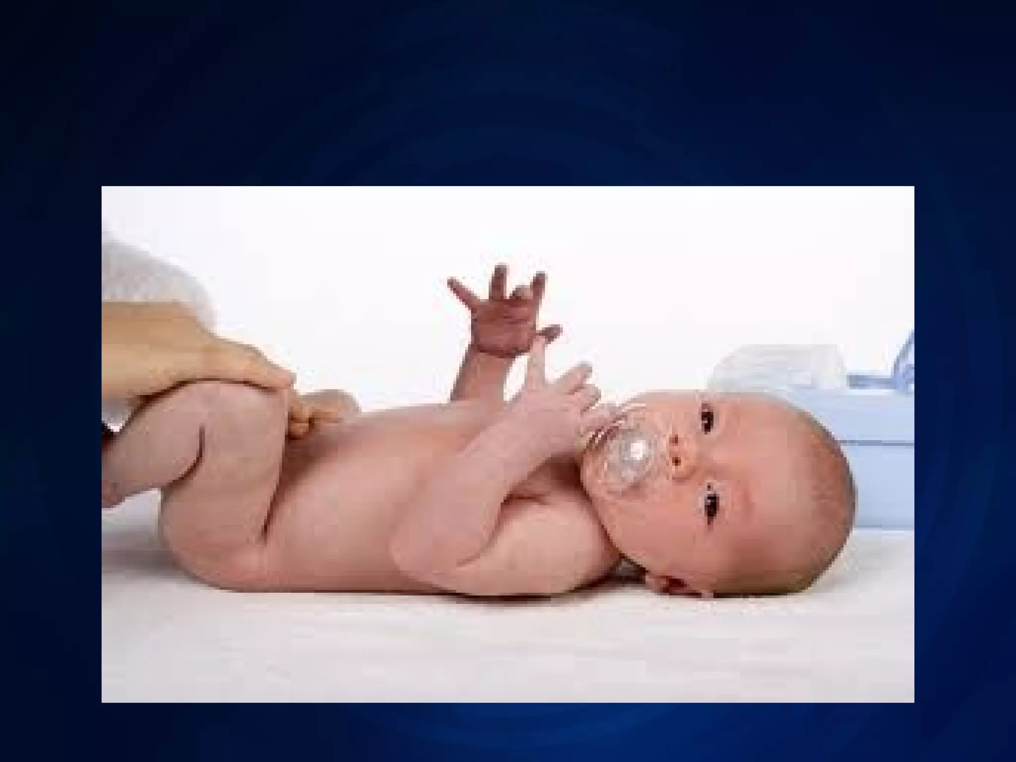 Newborn Examination | PPT