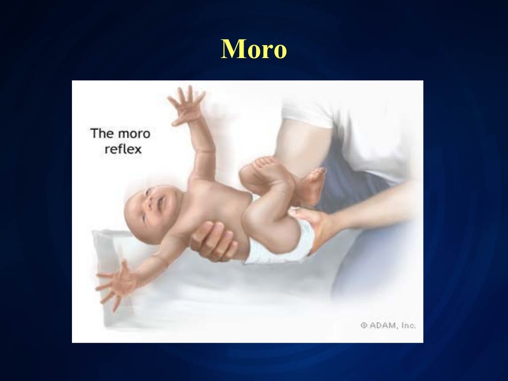 Newborn Examination Newborn Examination