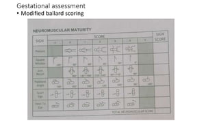 Newborn examination | PPTX