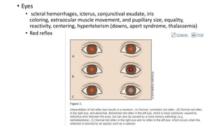 Newborn examination | PPT