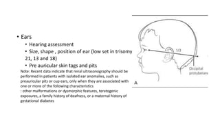 Newborn examination | PPT