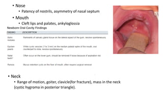 Newborn examination | PPT