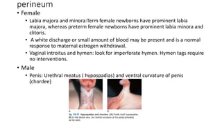 Newborn examination | PPT