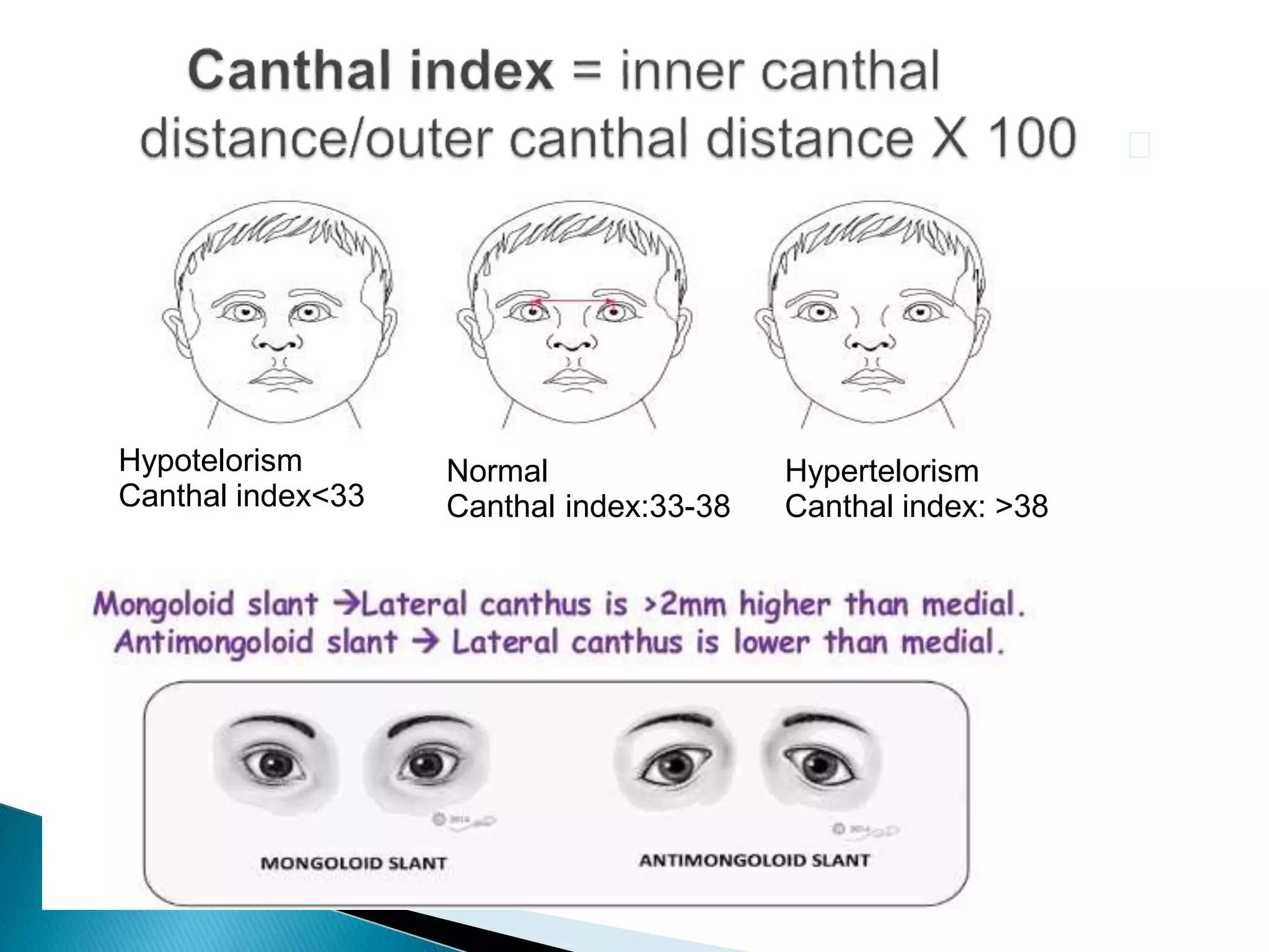 Newborn examination | PPTX