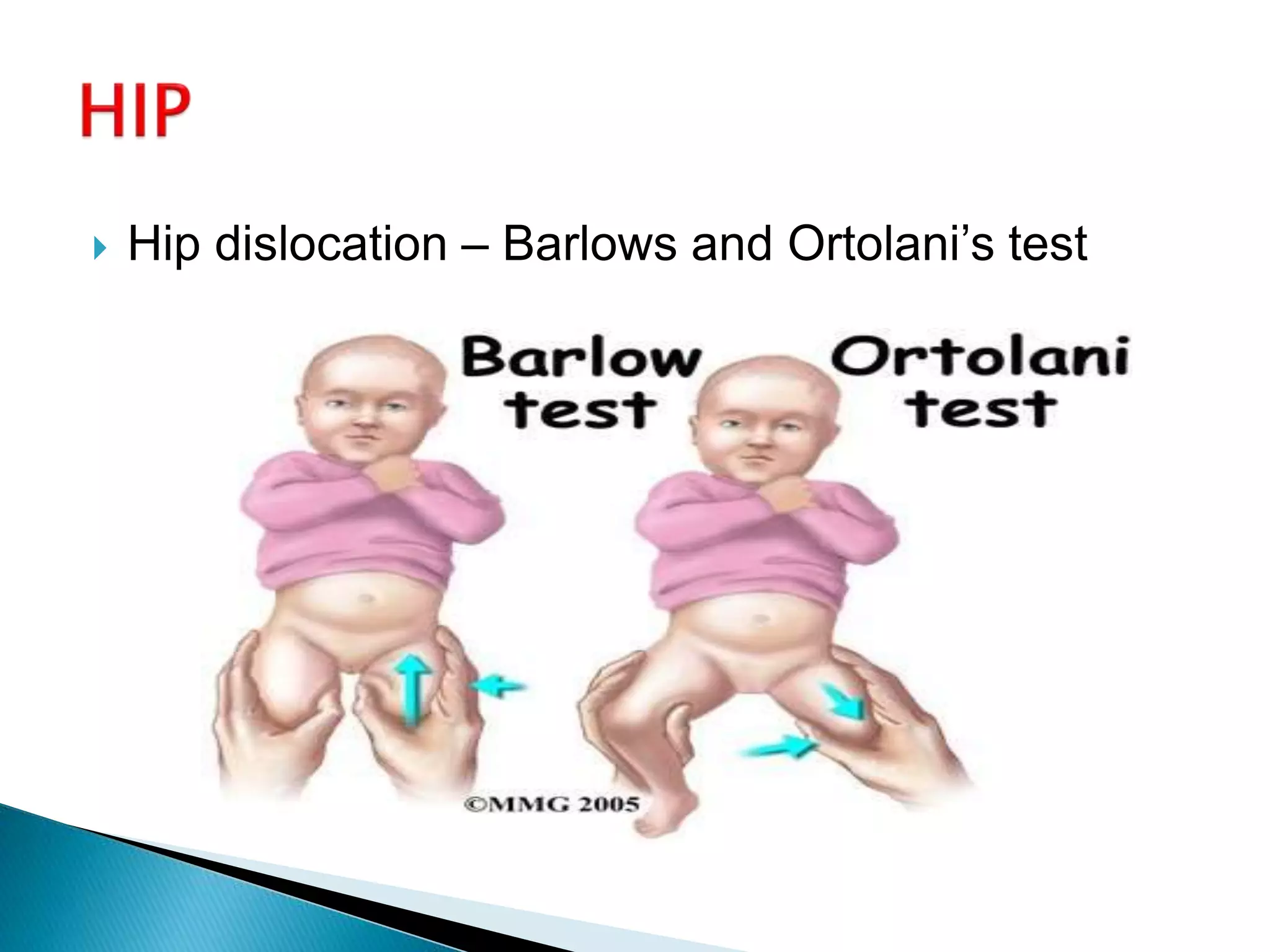 Newborn examination | PPTX