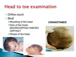 Newborn examination | PPTX