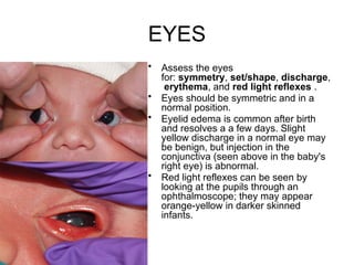 NEWBORN EXAMINATION in pediatrics and obgy | PPTX