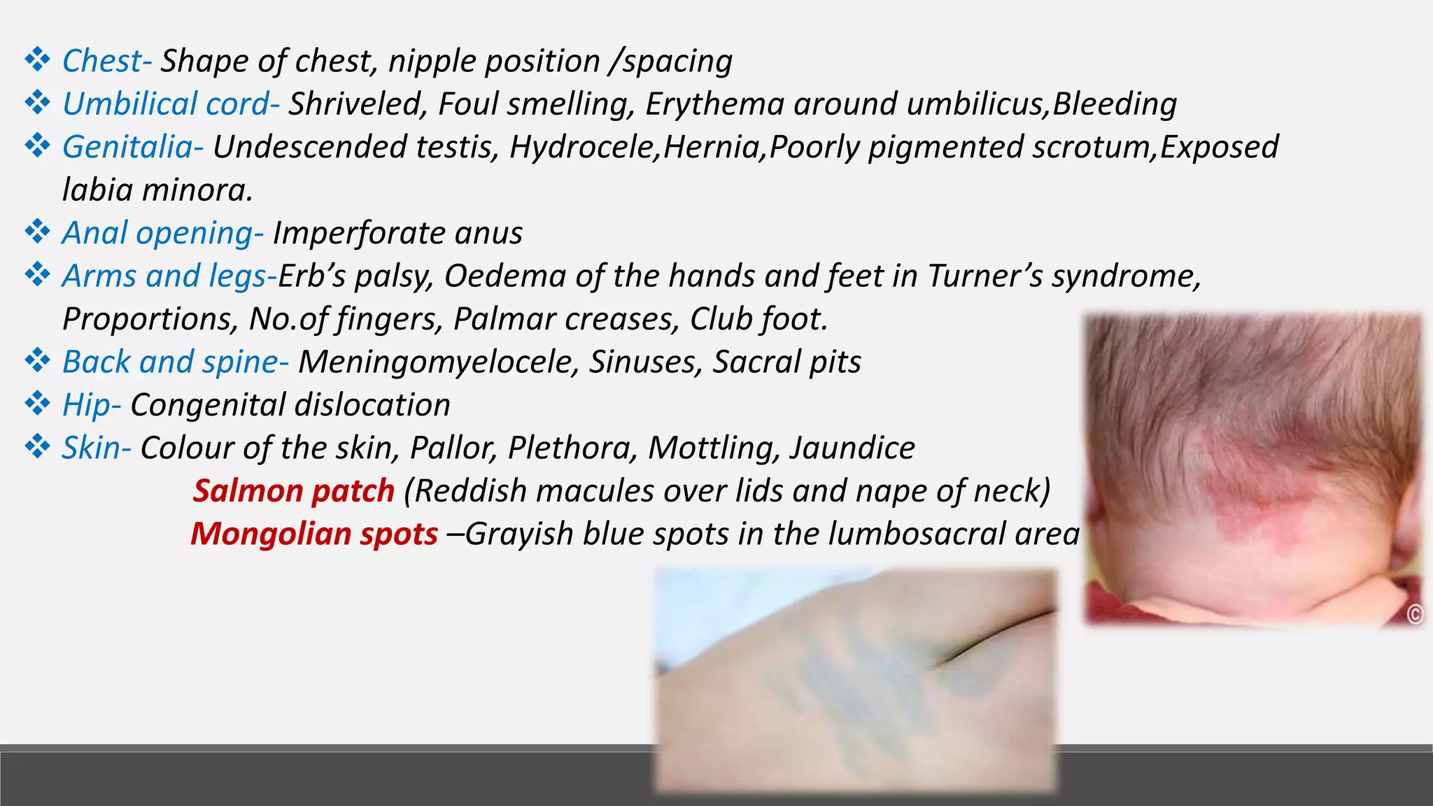 NEWBORN EXAMINATION-REFLEXES.pptx