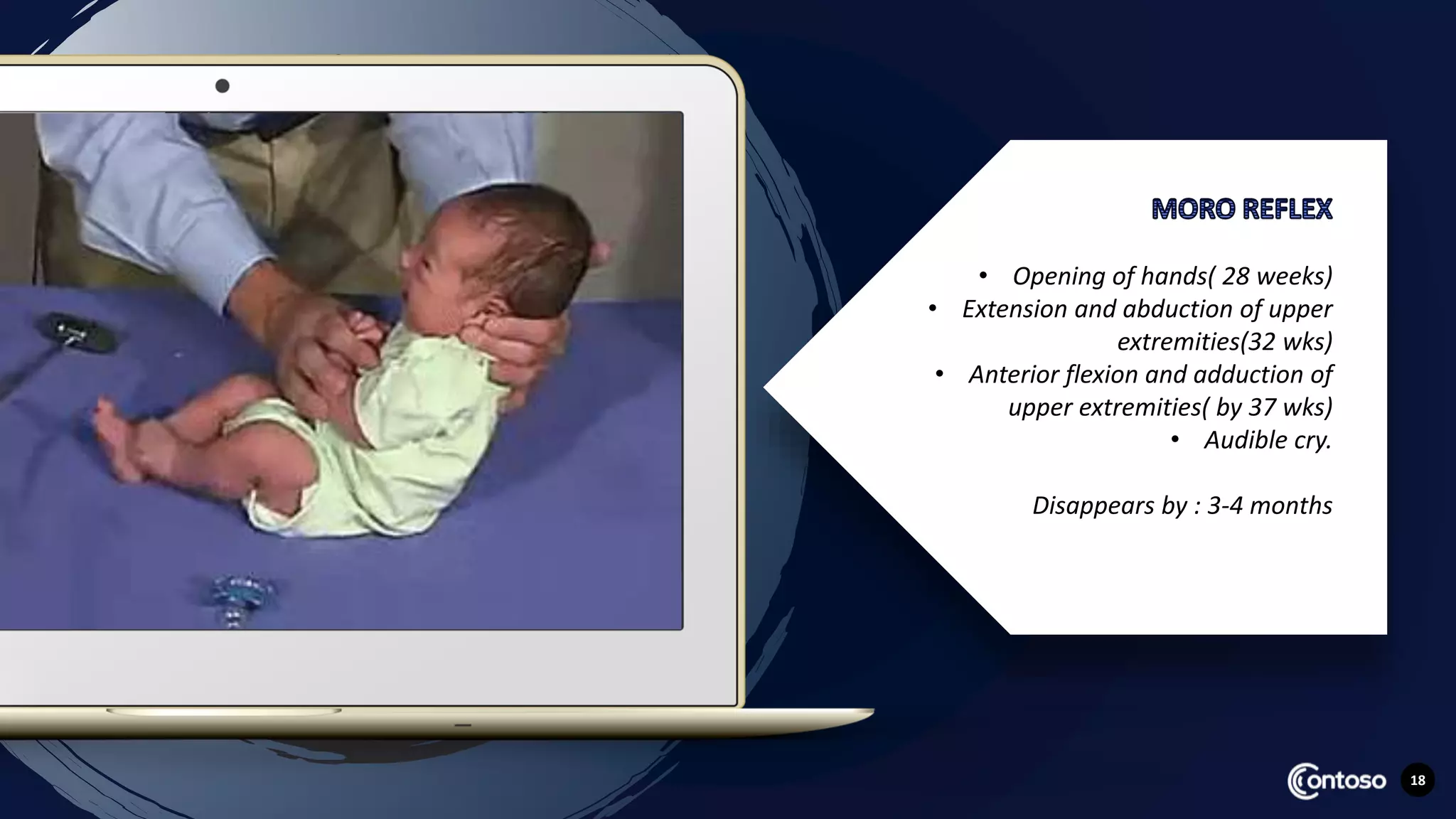 NEWBORN EXAMINATION-REFLEXES.pptx