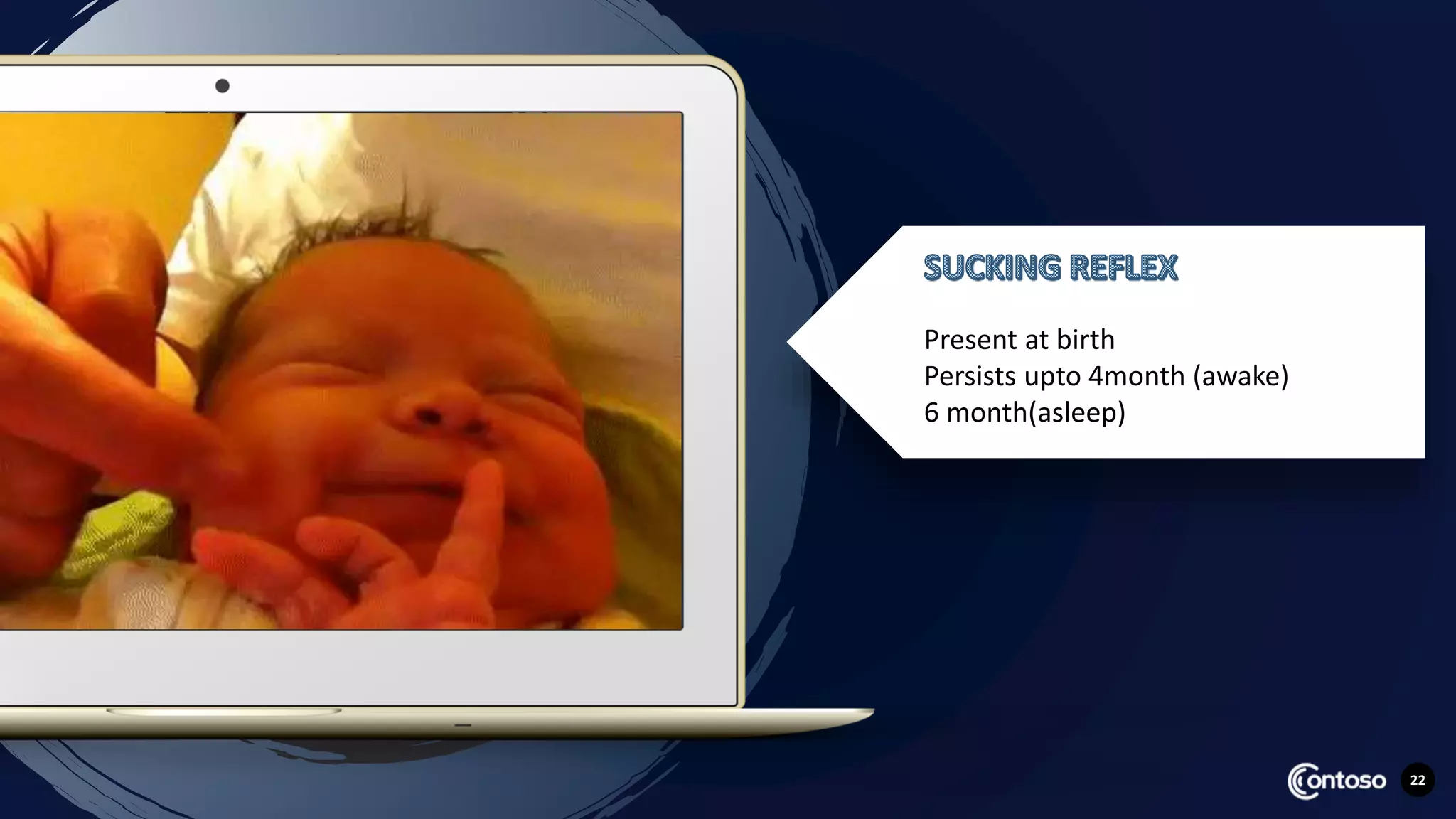 NEWBORN EXAMINATION-REFLEXES.pptx